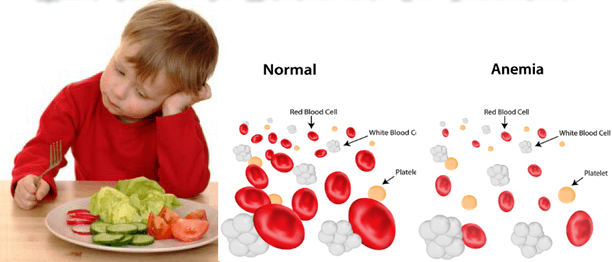 Main Causes Of Anemia Diseases And Its Medical Treatment - iTechnHealth.com